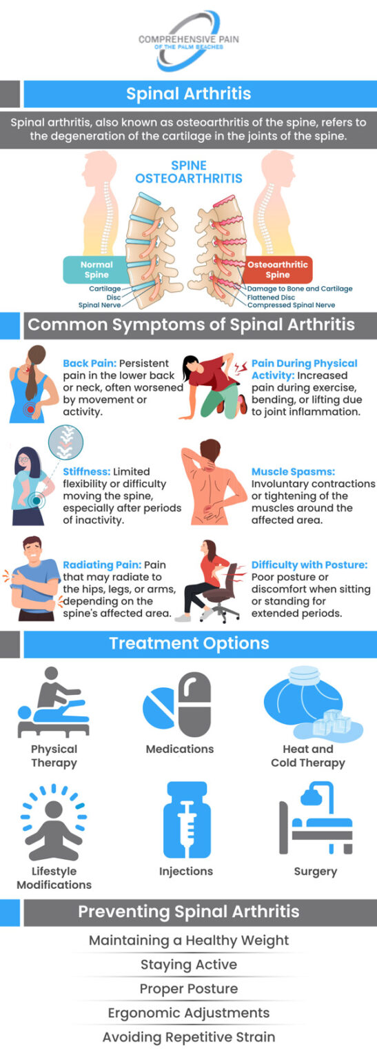 Spinal Arthritis Treatment in Greenacres, FL and Port St. Lucie, FL